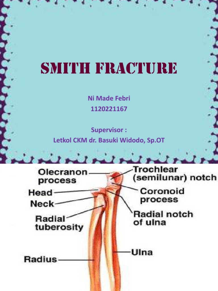 Overview of Smith Fracture Management | PDF | Self-Improvement ...