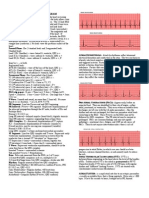 Pac PJC PVC | PDF | Cardiac Electrophysiology | Cardiac Arrhythmia