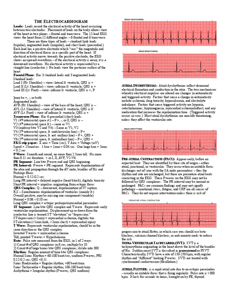 The Electrocardiogram | PDF | Cardiac Arrhythmia | Electrocardiography