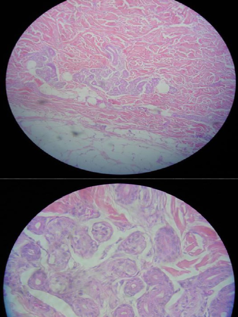 Examen de Laminillas | PDF | Membrana mucosa | Estómago