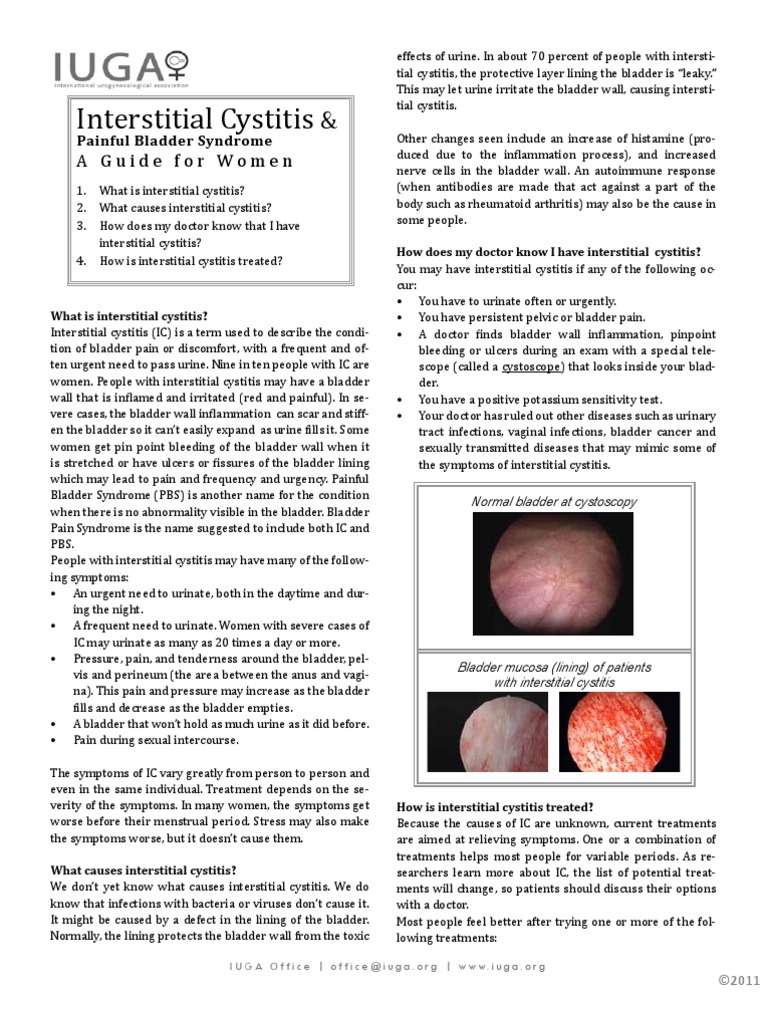 Interstitial Cystitis & Painful Bladder Syndrome: A Guide For Women ...