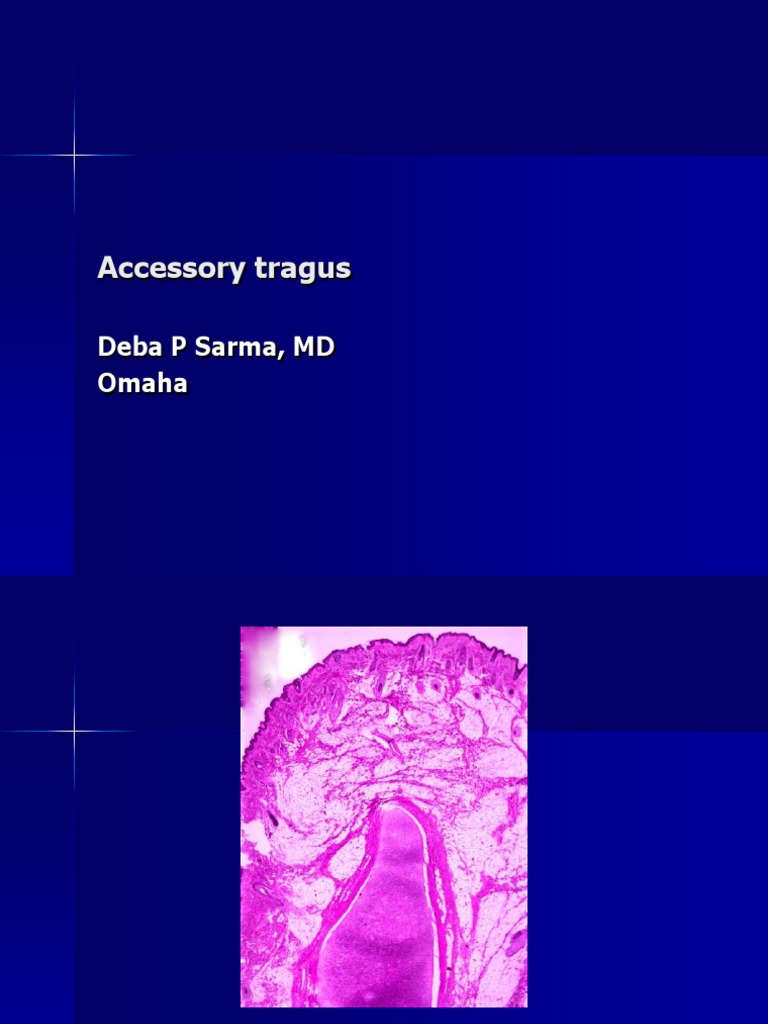 Accessory Tragus | PDF