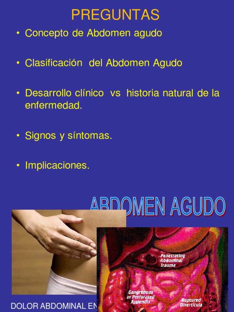 Abdomen agudo | Abdomen | Especialidades Medicas