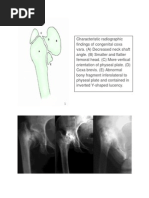 Crowe Classification of Hip Dysplasia | PDF | Hip | Musculoskeletal ...