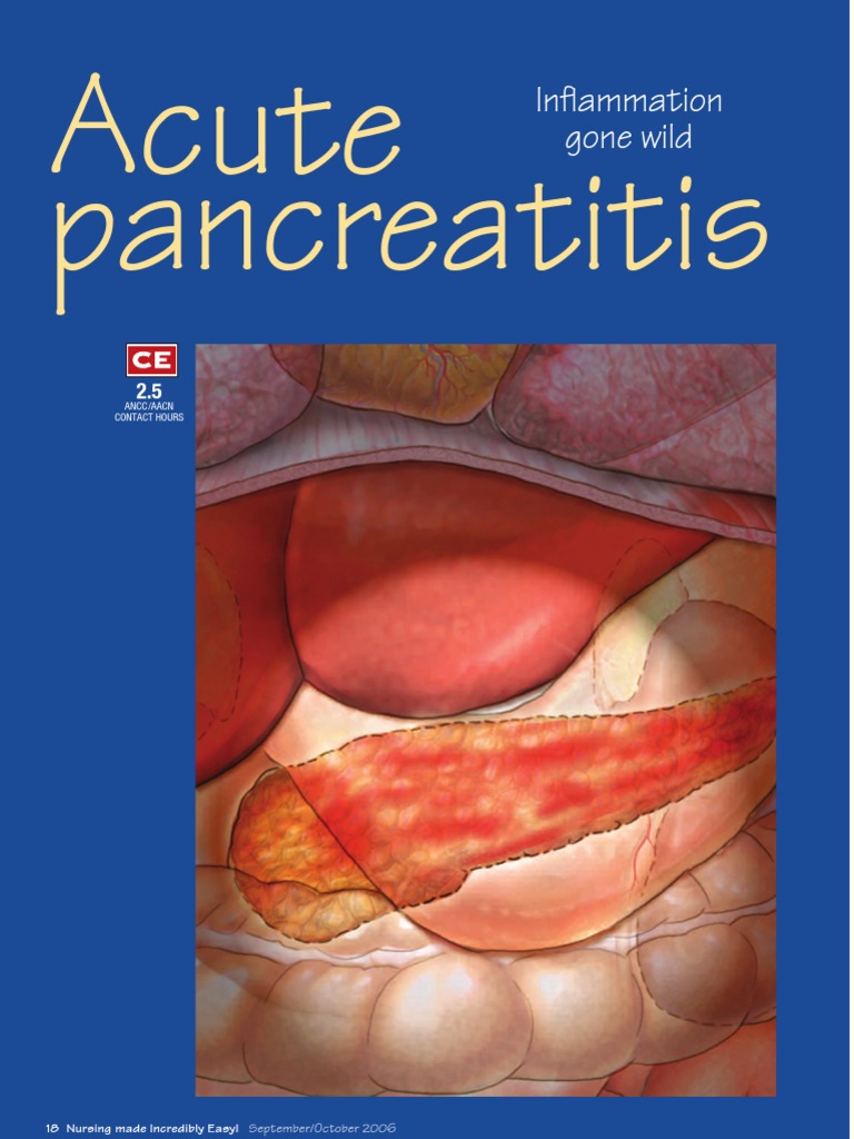 Acute Pancreatitis | PDF | Pancreas | Medical Specialties