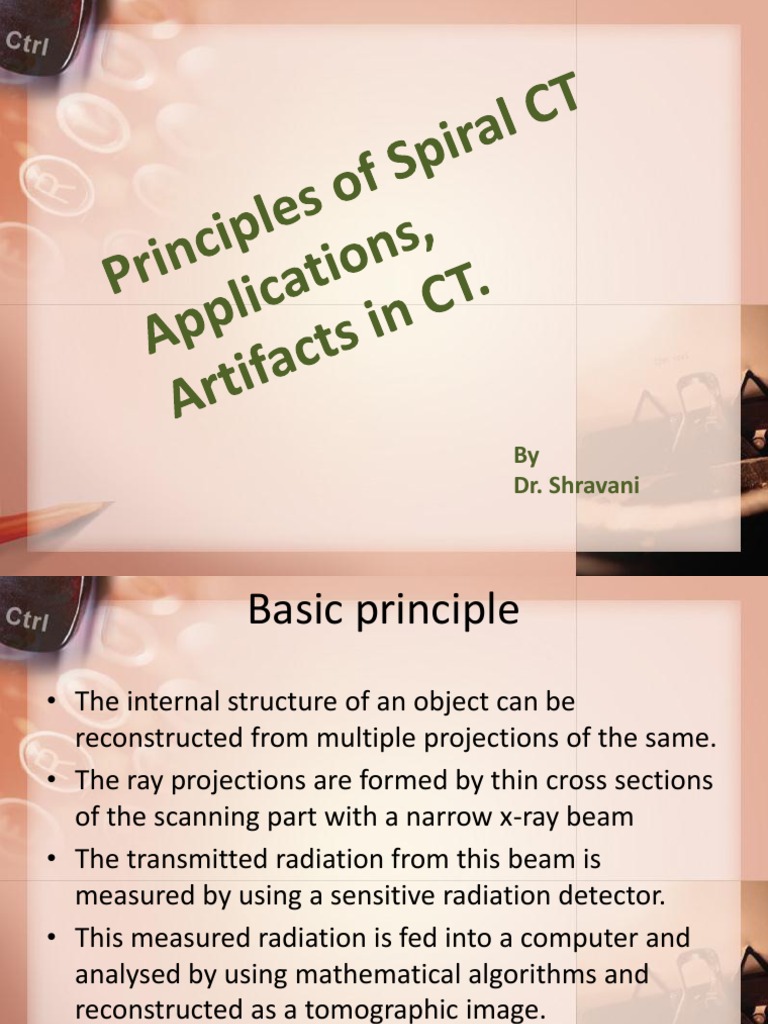 Principles of Spiral CT Scanning | PDF | Ct Scan | X Ray