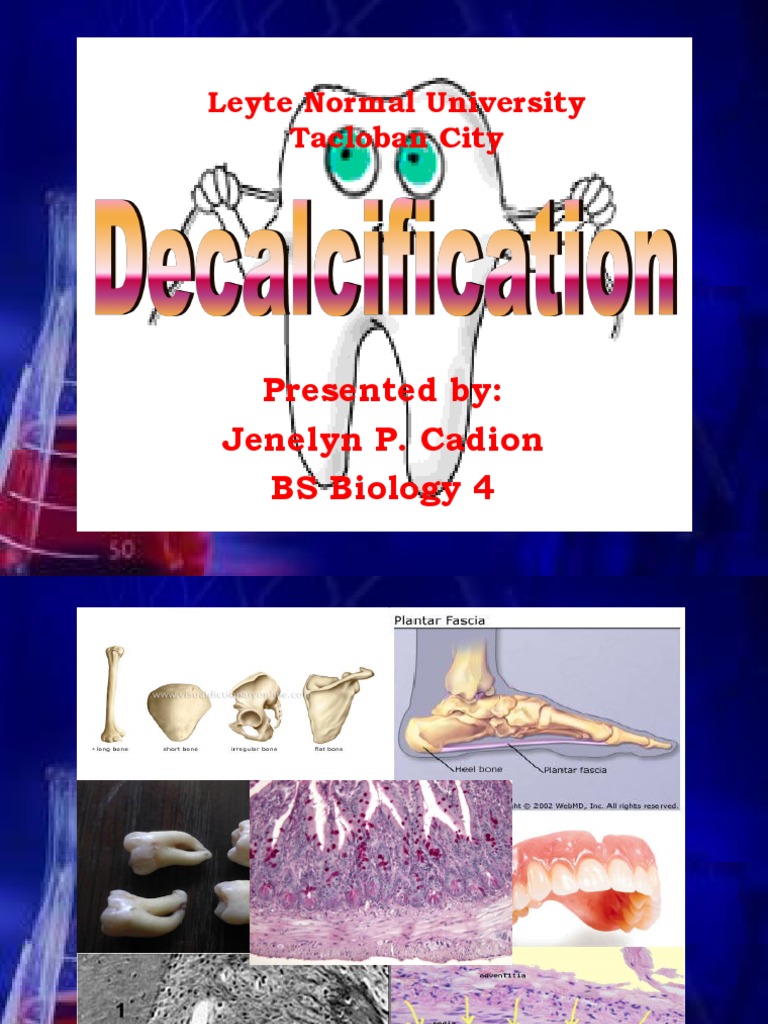 Decalcification | Staining | Nitric Acid