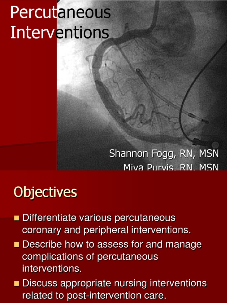 Nursing Care for Percutaneous Interventions | PDF | Percutaneous ...