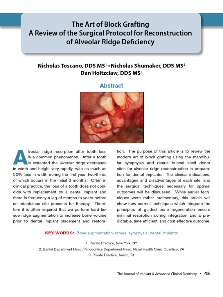 A Review of The Surgical Protocol For Reconstruction of Alveolar Ridge ...