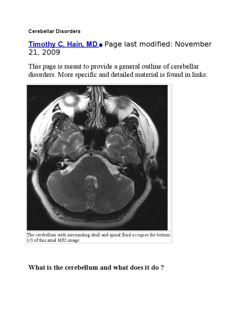 Cerebellar Disorders | Cerebellum | Earth & Life Sciences | Free 30-day ...