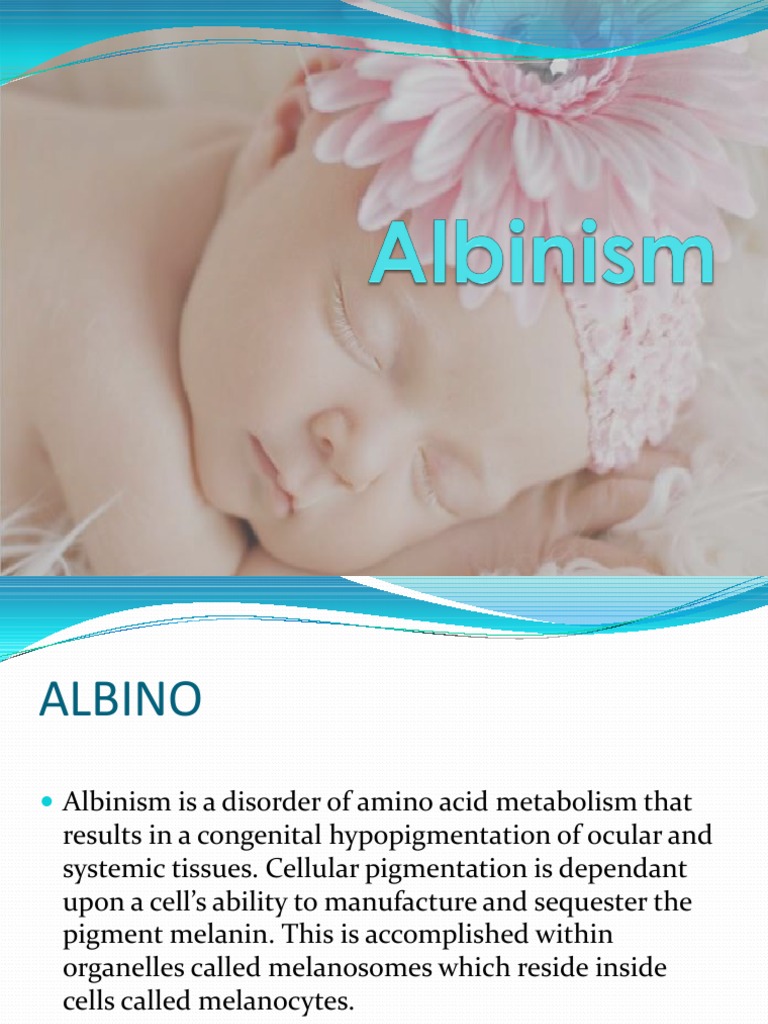 Albinism | PDF | Vision | Medical Specialties