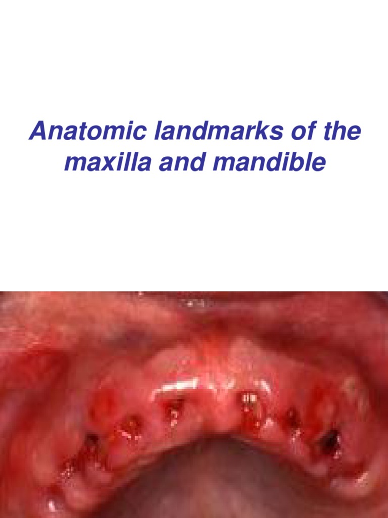 Anatomic Landmarks | Dentures | Mouth