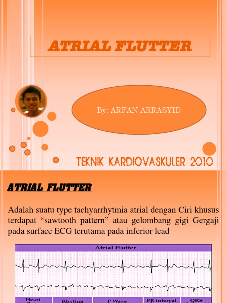 Panduan Atrial Flutter | PDF