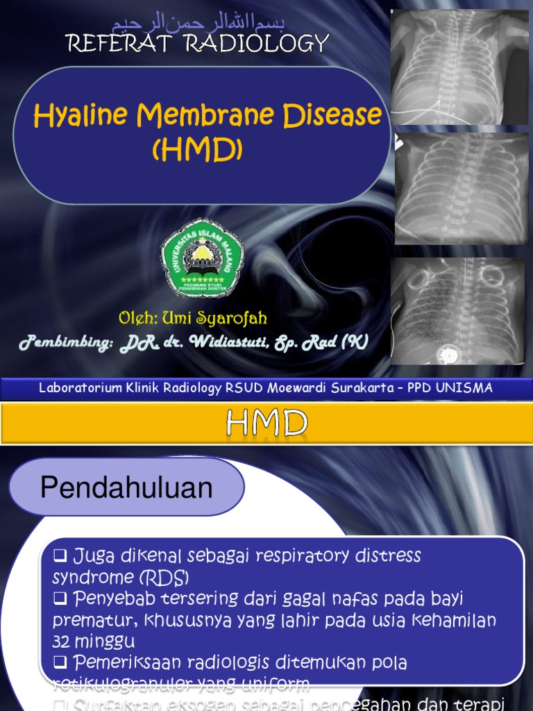 Hyaline Membrane Disease | PDF