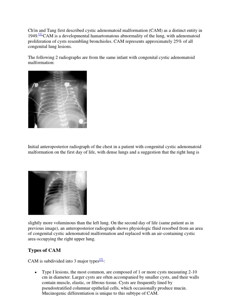 CCAM | Lung | Ct Scan