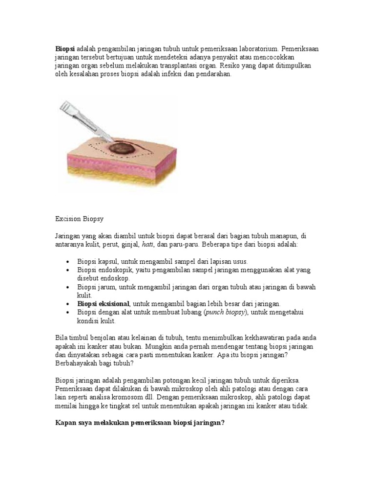 Biopsi Adalah Pengambilan Jaringan Tubuh Untuk Pemeriksaan Laboratorium ...