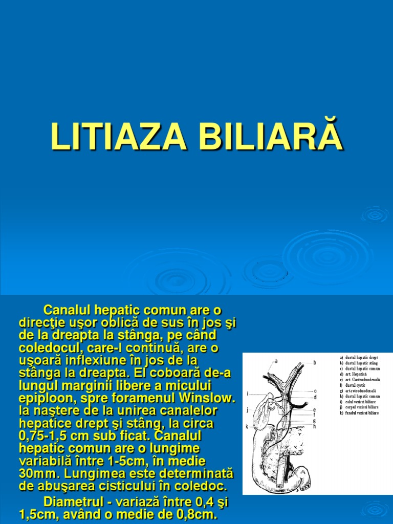 Litiaza Biliara | PDF
