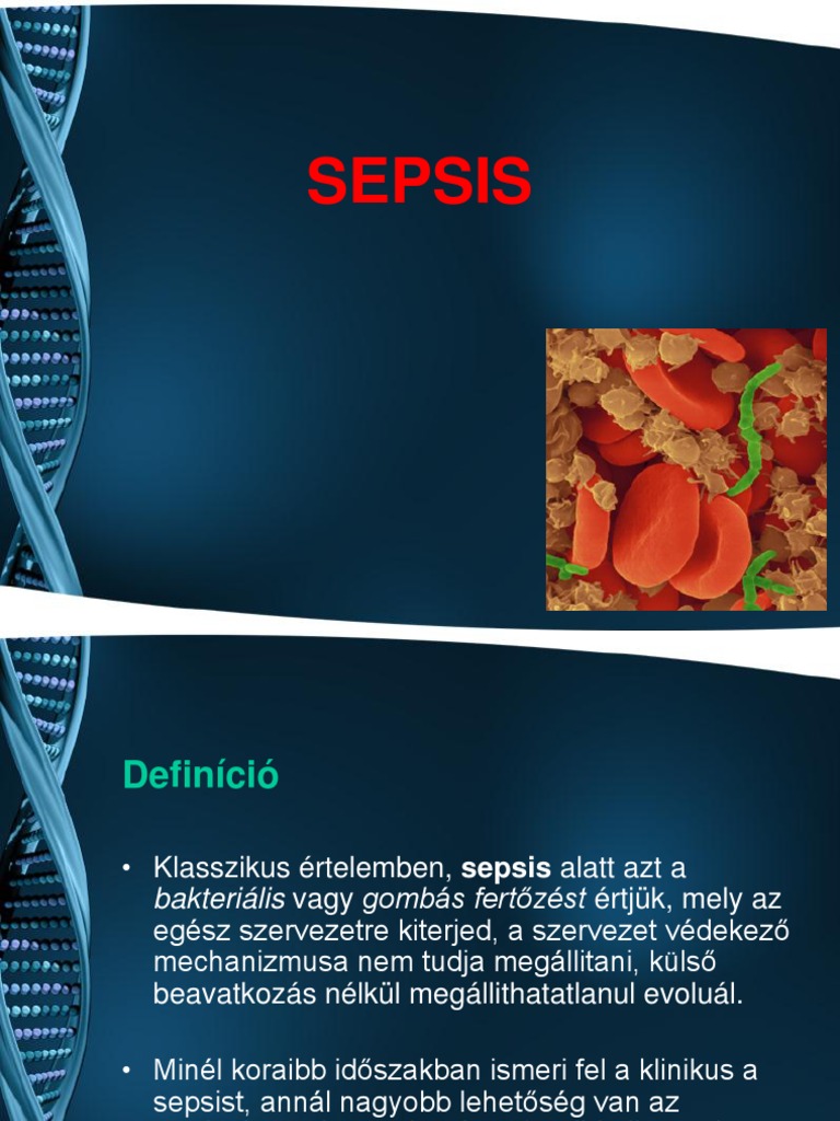 Sepsis