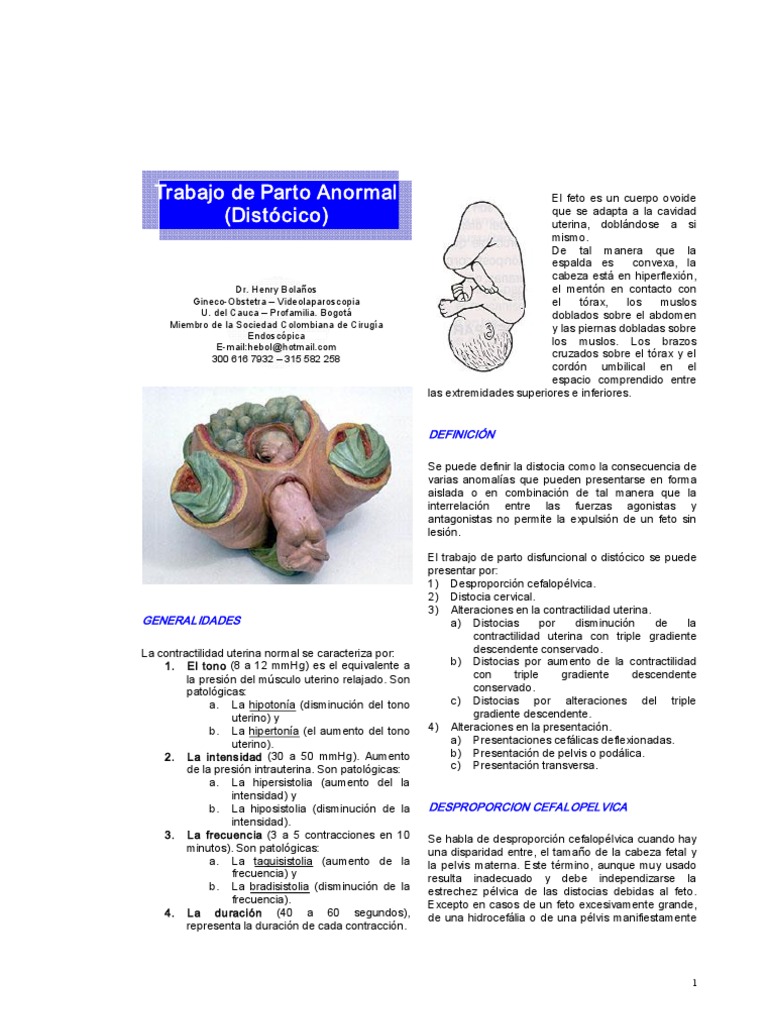 Distocias.pdf | Parto | Reproducción humana
