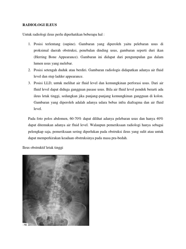 Gambaran Radiologi Ileus dan Herring Bone | PDF