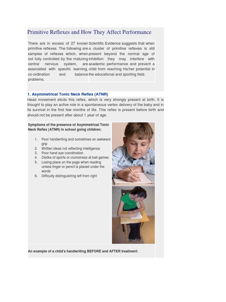 Primitive Reflexes and How They Affect Performance | PDF | Nervous ...