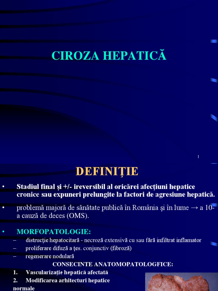 ciroza hepatica