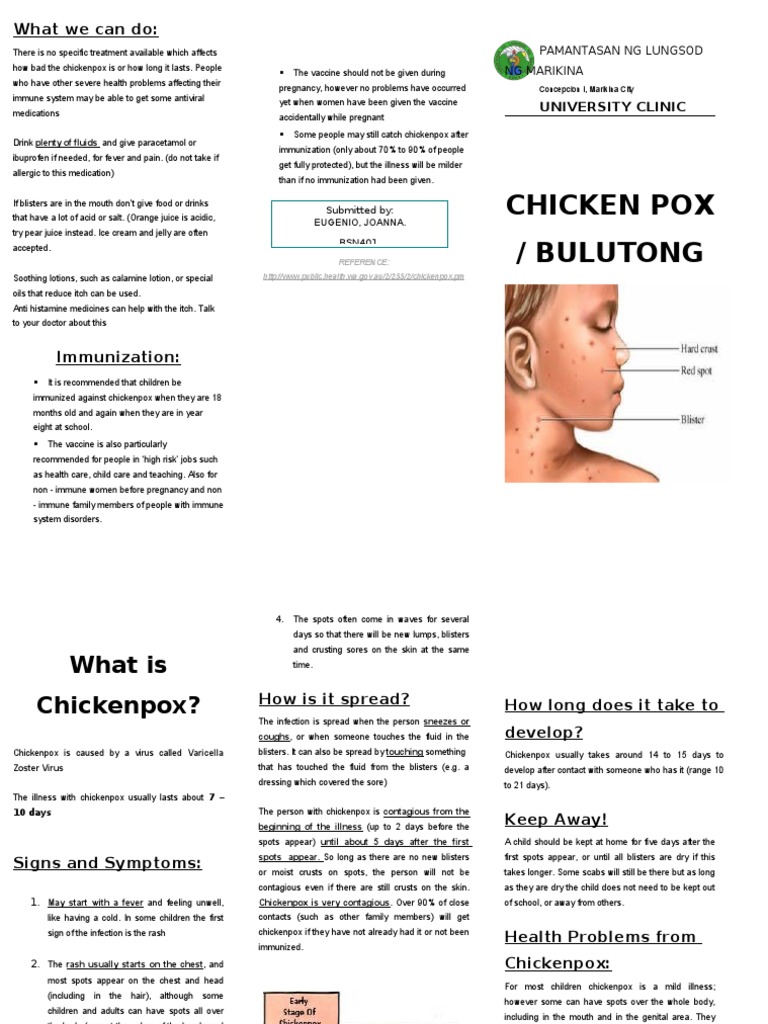 Chickenpox Pamphlet (Tagalog) | PDF | Animal Viral Diseases | Immunology