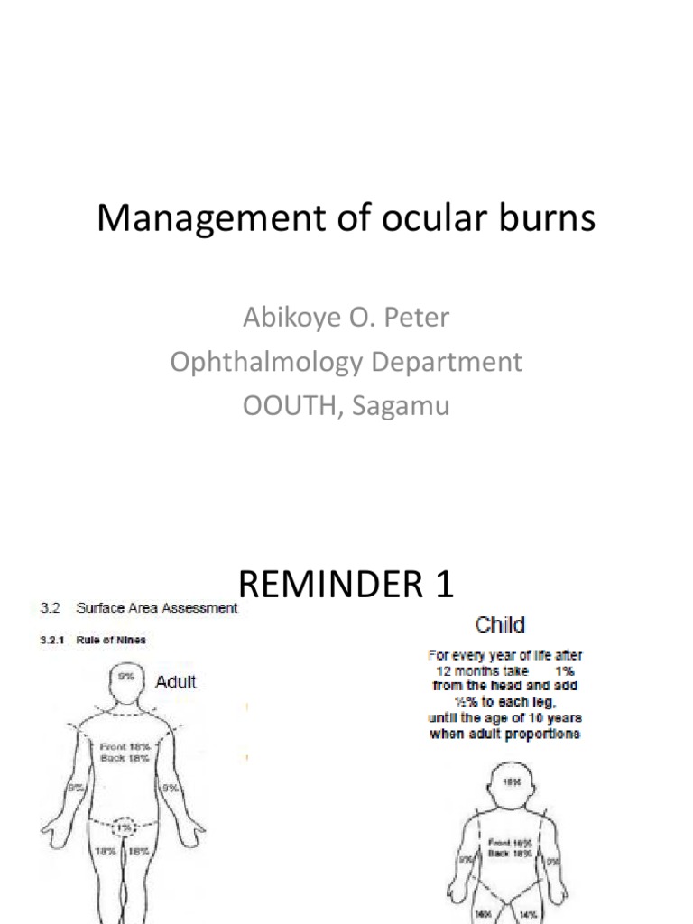 Management of Ocular Burns | PDF | Cornea | Human Eye