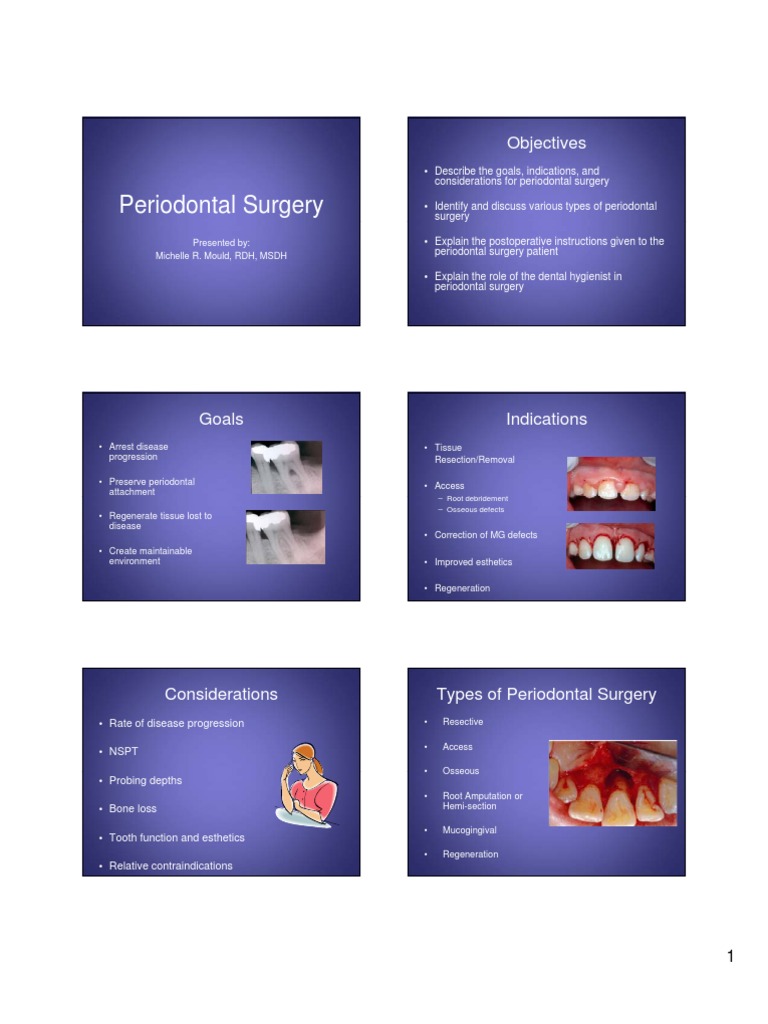 Periodontal Surgery: Objectives | PDF | Mouth | Dentistry