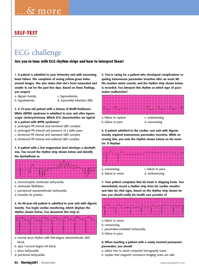 More: ECG Challenge | PDF | Electrocardiography | Artificial Cardiac ...