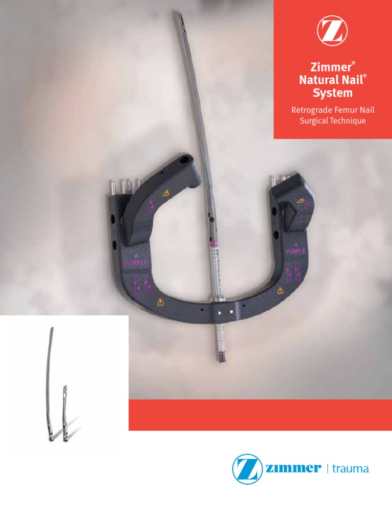 Znn retrograde nail | Screw | Hip