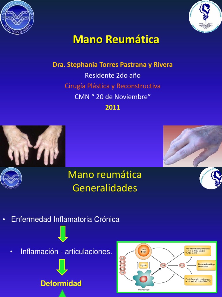 Mano Reumática Steph 2011 PDF | PDF | Mano | Articulación