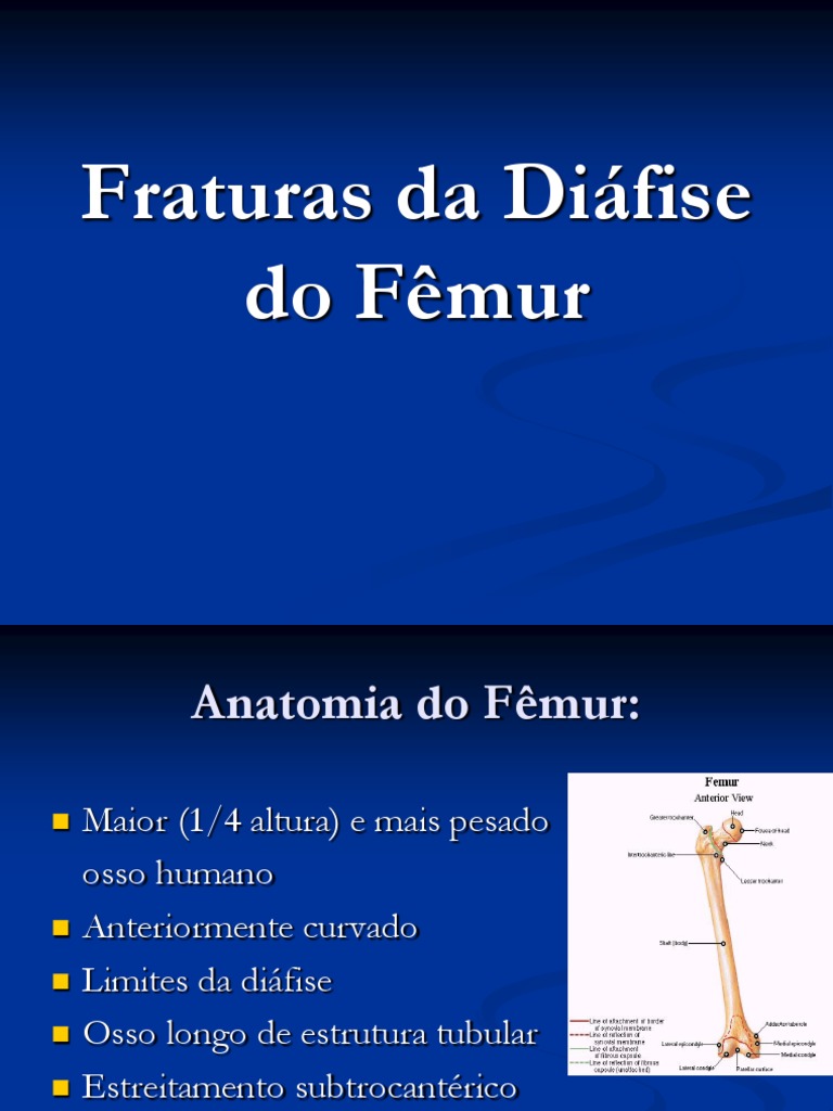 Fraturas Da Diafise de Femur | PDF | Artéria | Sistema Locomotor