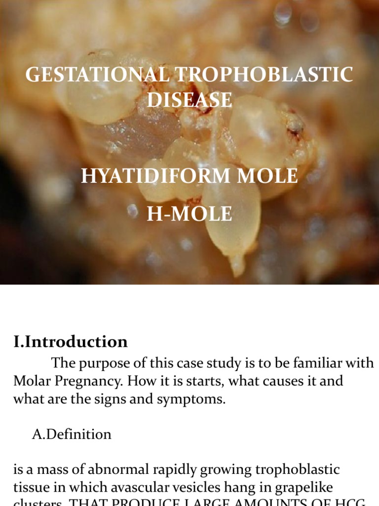 H Mole | PDF | Medical Ultrasound | Health Sciences