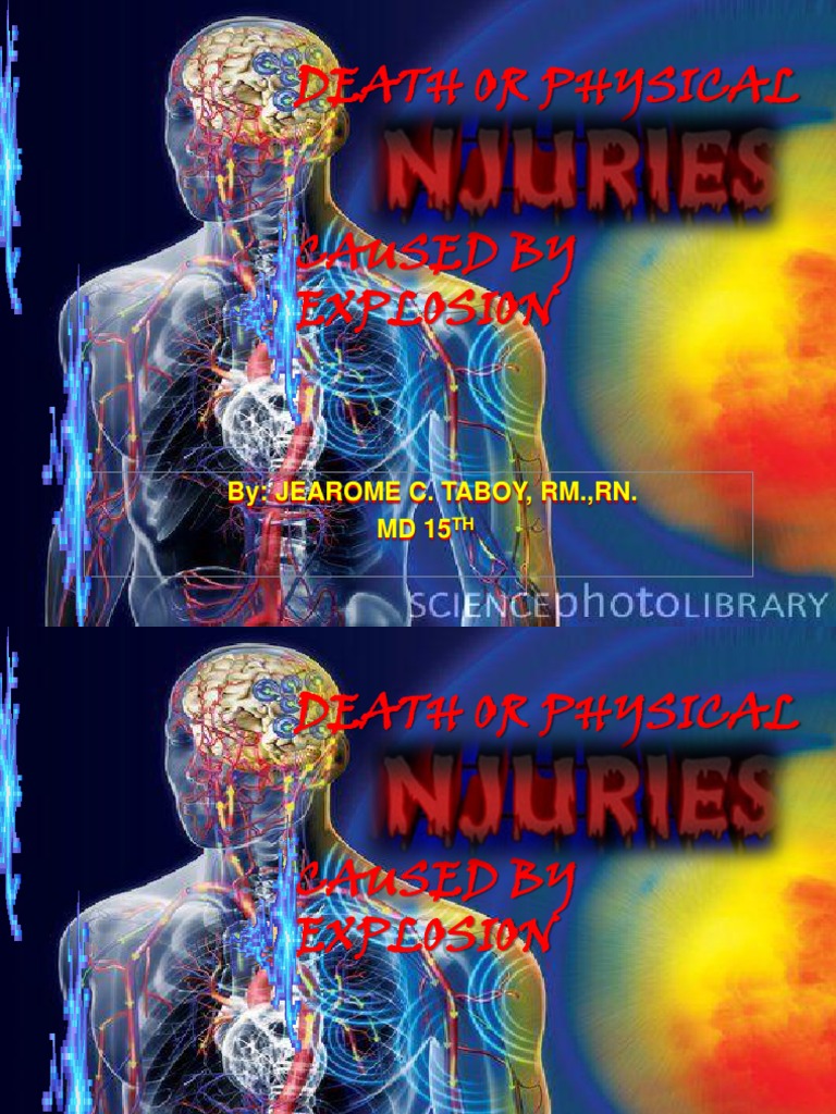 Death or Physical Injuries Caused by Explosion | PDF | Explosion ...