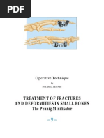 Acumed ES Surgical Technique Fibula Nail 2 ESFNA10 02 A | PDF