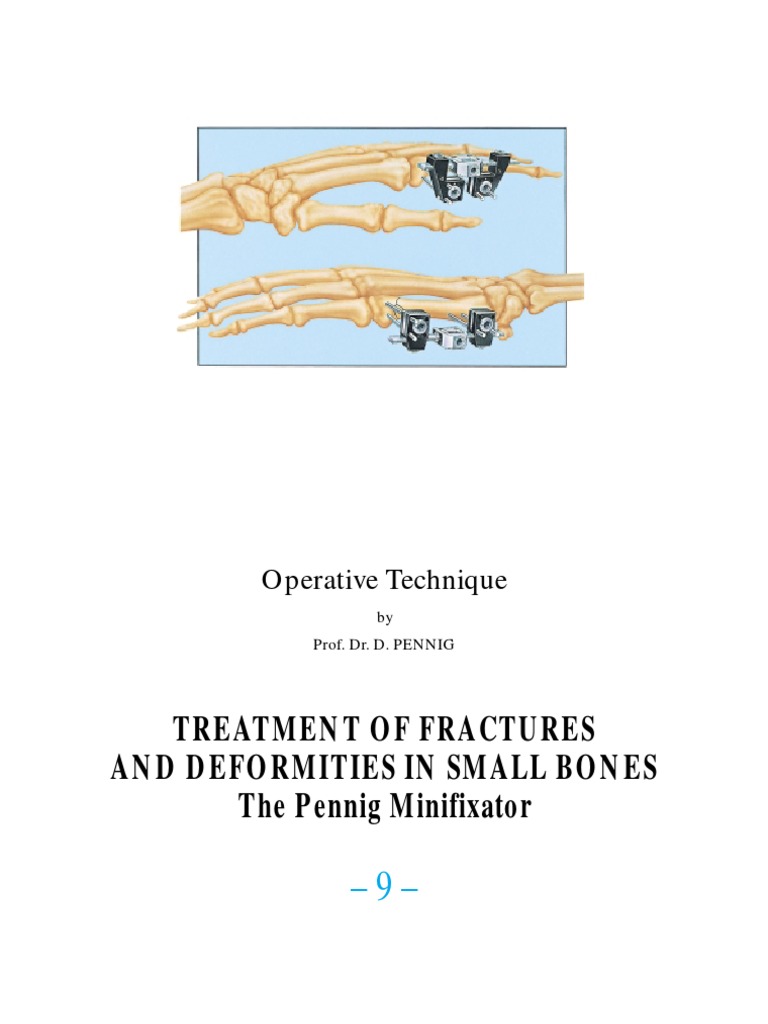 Penning Mini Fea | PDF | Finger | Skeletal System