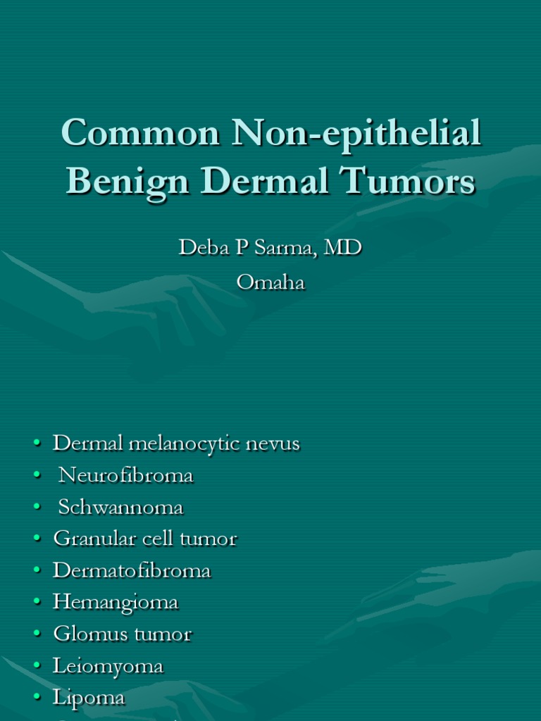 Common Benign Dermal Tumors Guide | PDF | Science & Mathematics | Law