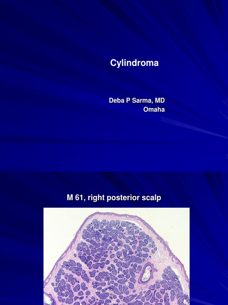 Cylindroma, M 61, Scalp | PDF | Home & Garden | Wellness