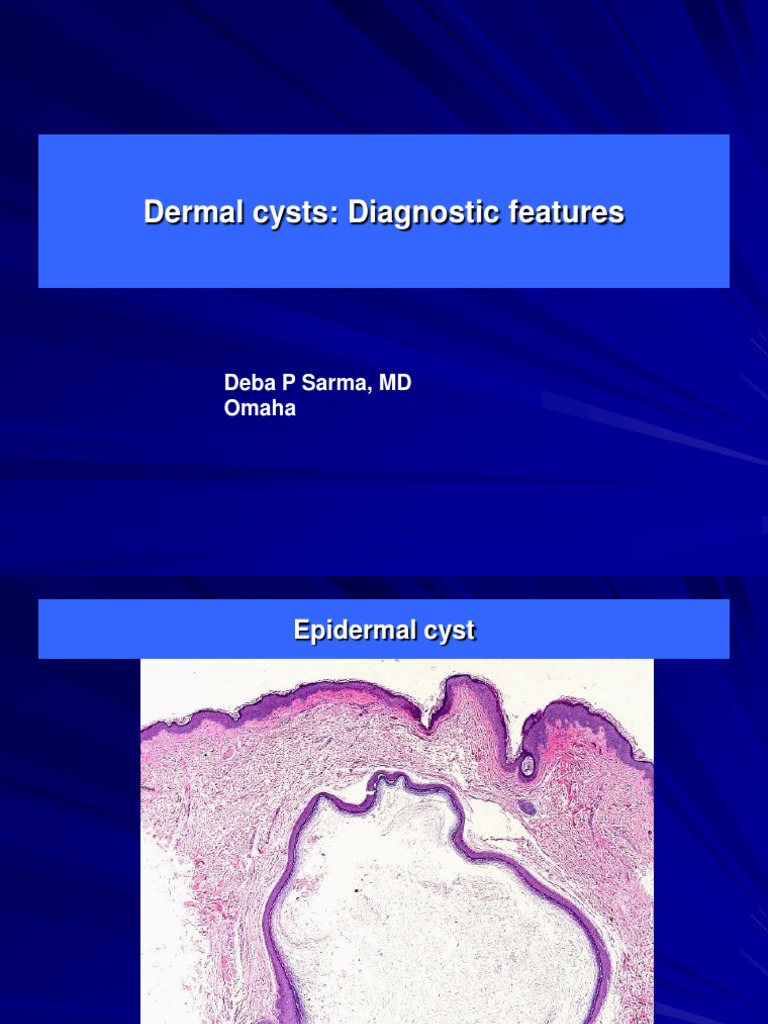 Dermal Cysts, Diagnostic Features | PDF | Wellness | Science & Mathematics