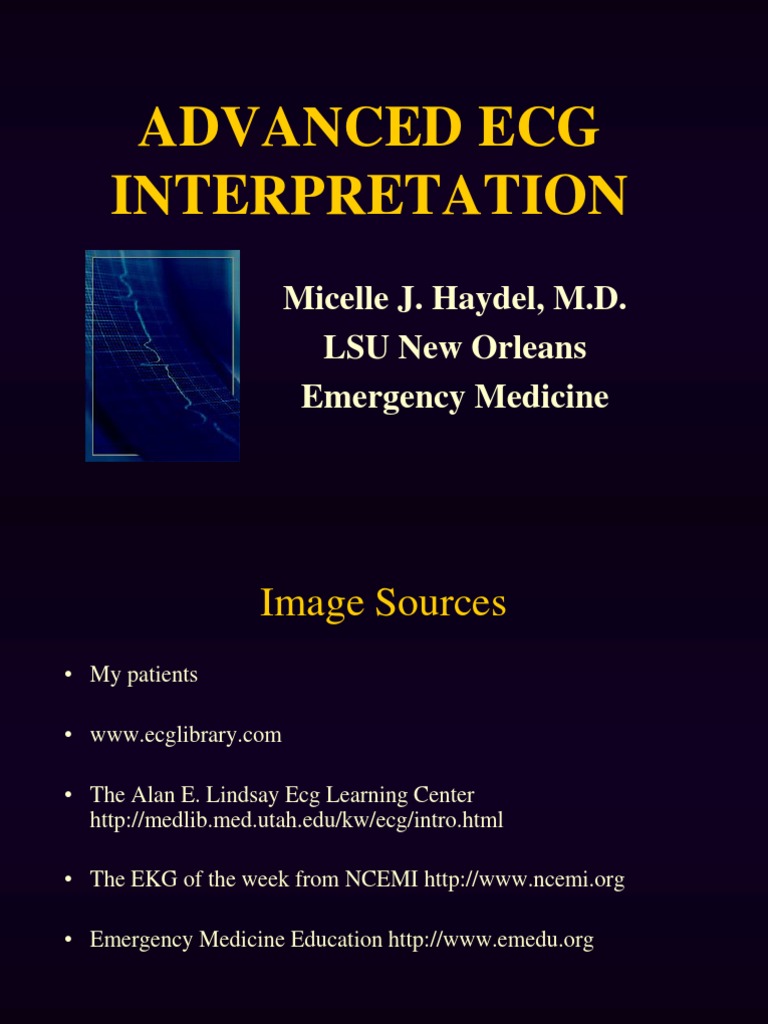 Advanced ECG Interpretation Guide | PDF | Cardiac Arrhythmia ...