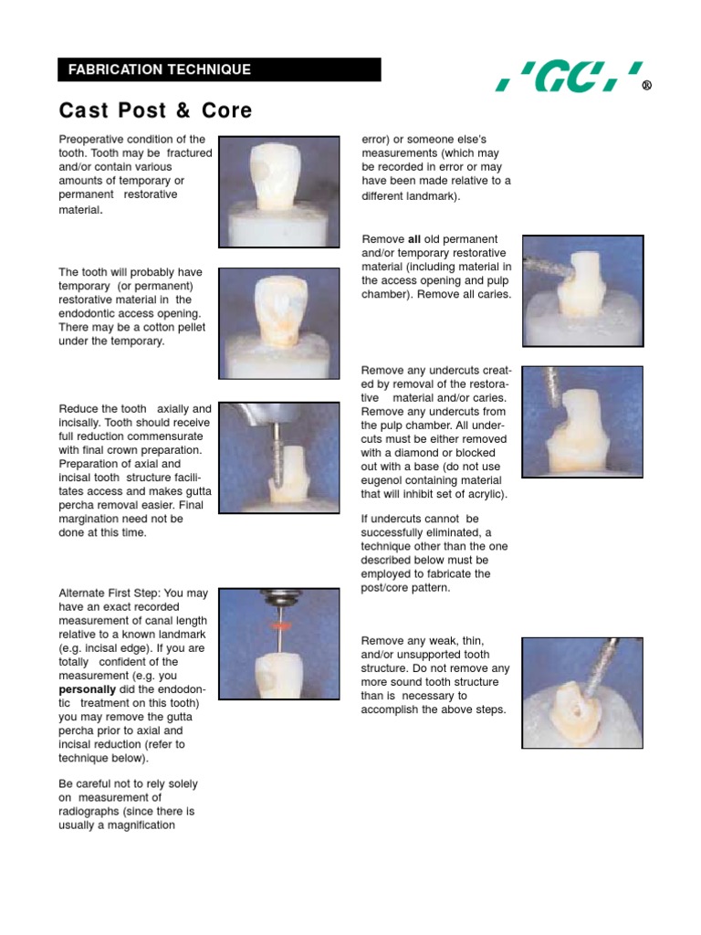 Cast Post | PDF | Dentistry | Nature