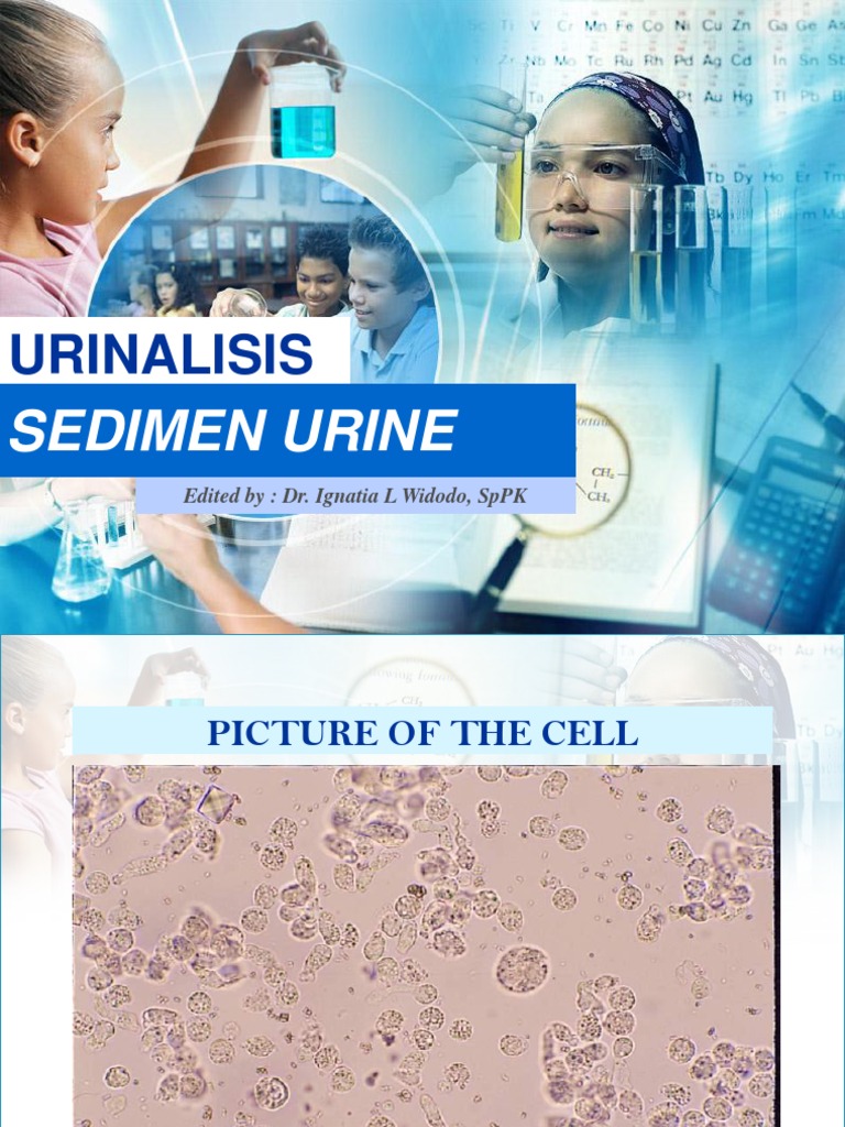 Sedimen Urine | PDF | Urine | Urinary System