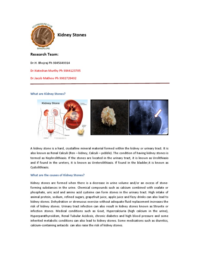 A Comprehensive Review of Kidney Stones: Causes, Symptoms, Risk Factors ...
