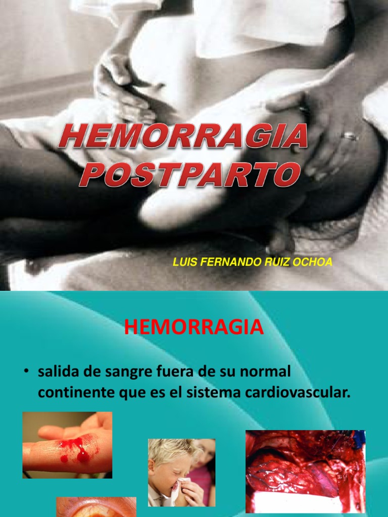 Manejo de Hemorragia Postparto | PDF | Parto | Placenta