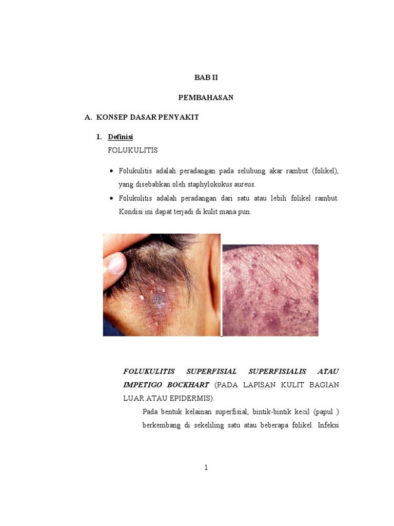 Folikulitis Superfisial | PDF