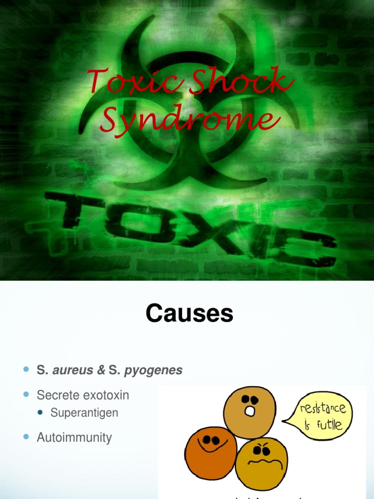 Toxic Shock Syndrome Causes and Symptoms | PDF | Inflammation | Immune ...