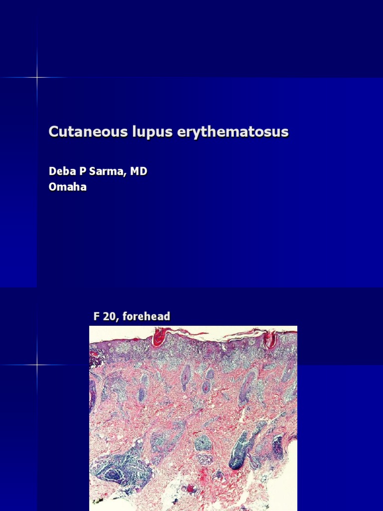 Cutaneous Lupus Erythematosus Diagnosis | PDF | Finance & Money Management