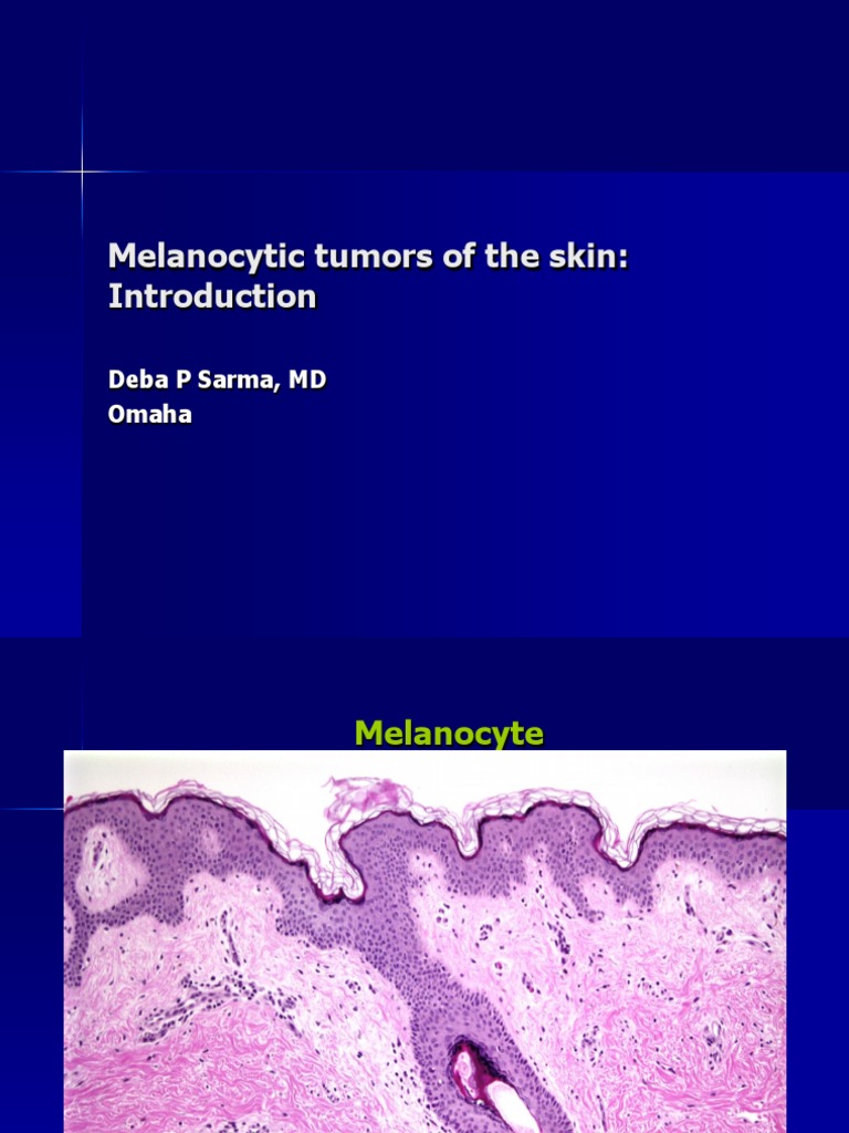 Melanocytic Tumors of the Skin. an Introduction. PPT | Melanoma | Dermatology