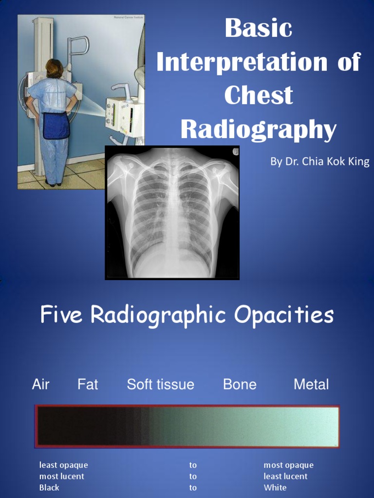 Chest X-ray Interpretation Guide | PDF | Lung | Thorax